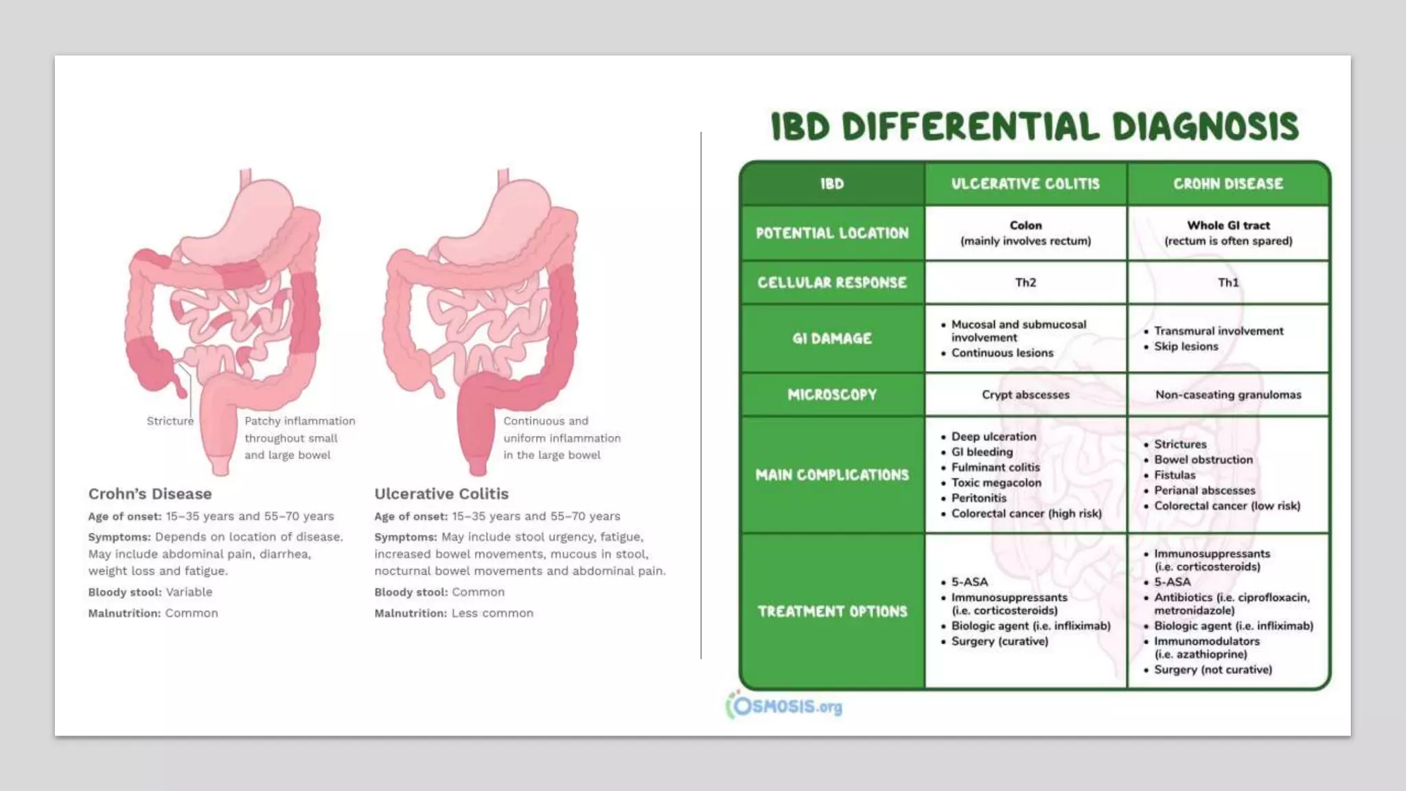 chronic colitis | PPTX