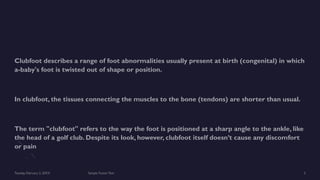 Club foot presentation definition and more details | PPTX