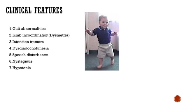 Presentation on Ataxia Pediatrics Cns.pptx