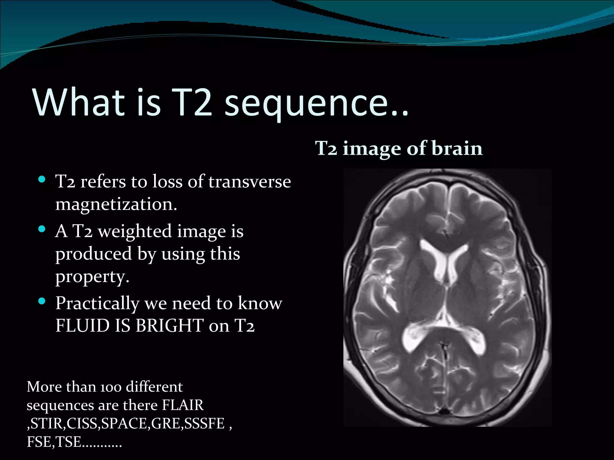 BASICS OF MRI | PPT
