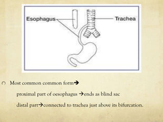 Esophagus Physiology