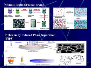 TISSUE ENGINEERING | PPT