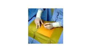 Basics of knee arthroscopic and diagnostics scope.pptx