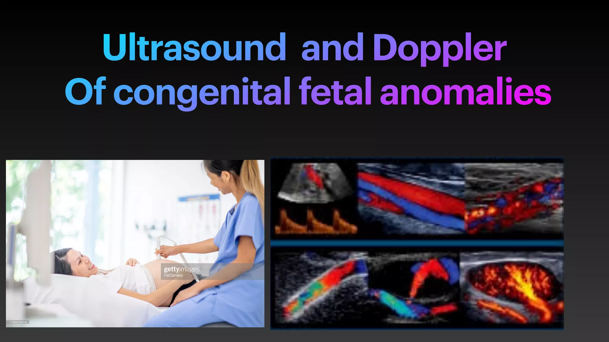 Presentation 13 doppler in fetal anomalies.pdf