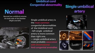 Presentation 13 doppler in fetal anomalies.pdf