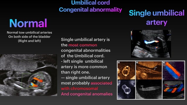Presentation 13 doppler in fetal anomalies.pdf