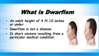 Dwarfism | PPTX