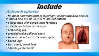 Dwarfism | PPTX