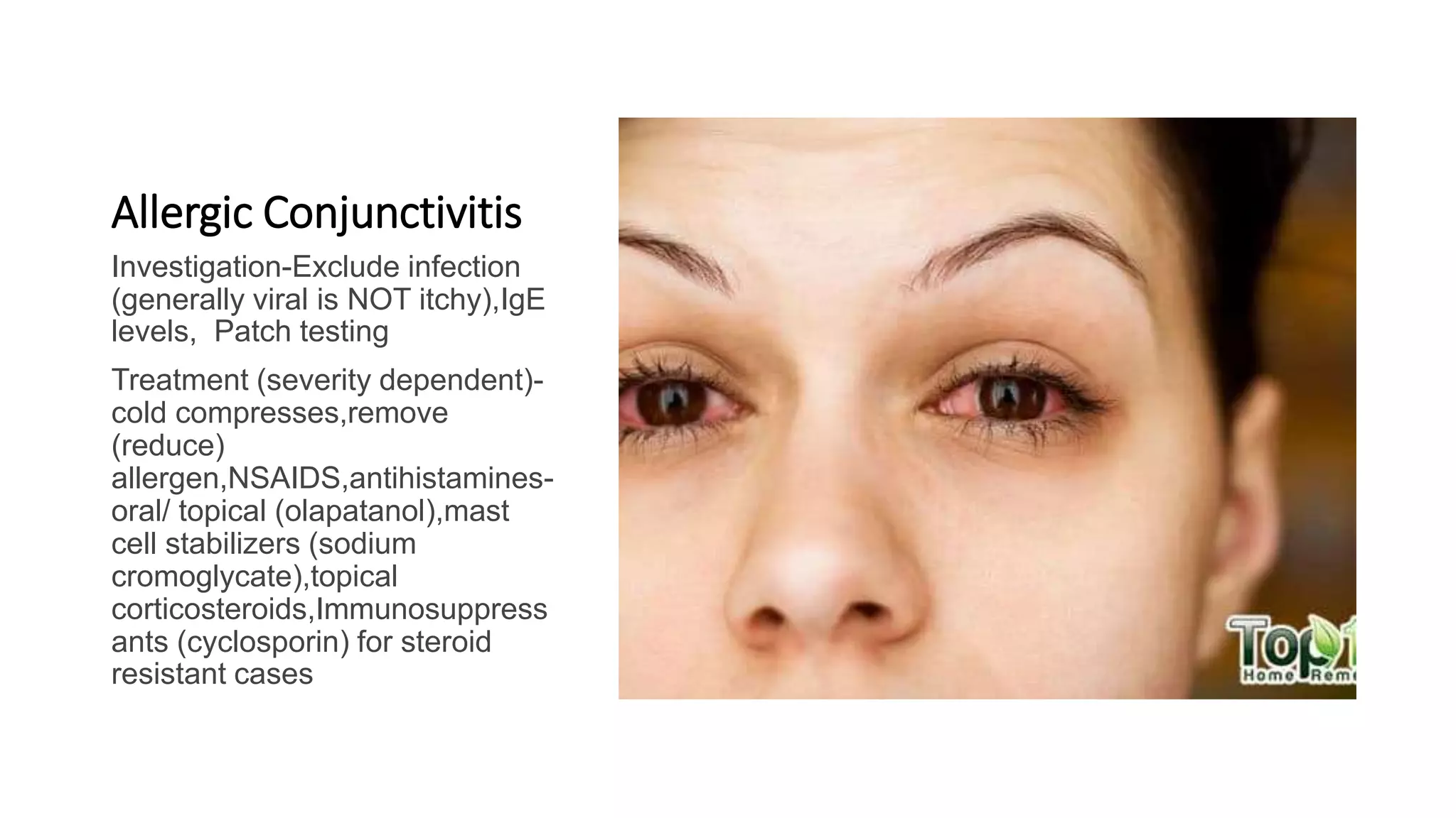 APPROACH TO RED EYE -DIAGNOSIS AND TREATMENT | PPTX