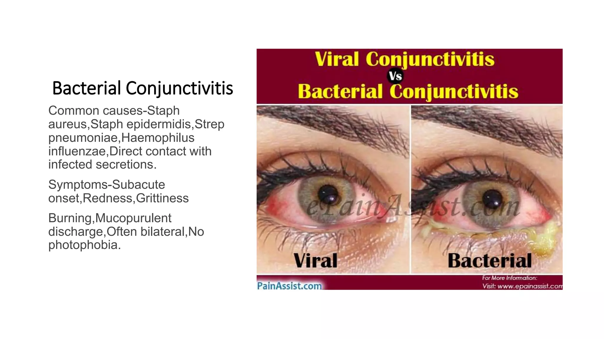 APPROACH TO RED EYE -DIAGNOSIS AND TREATMENT | PPTX