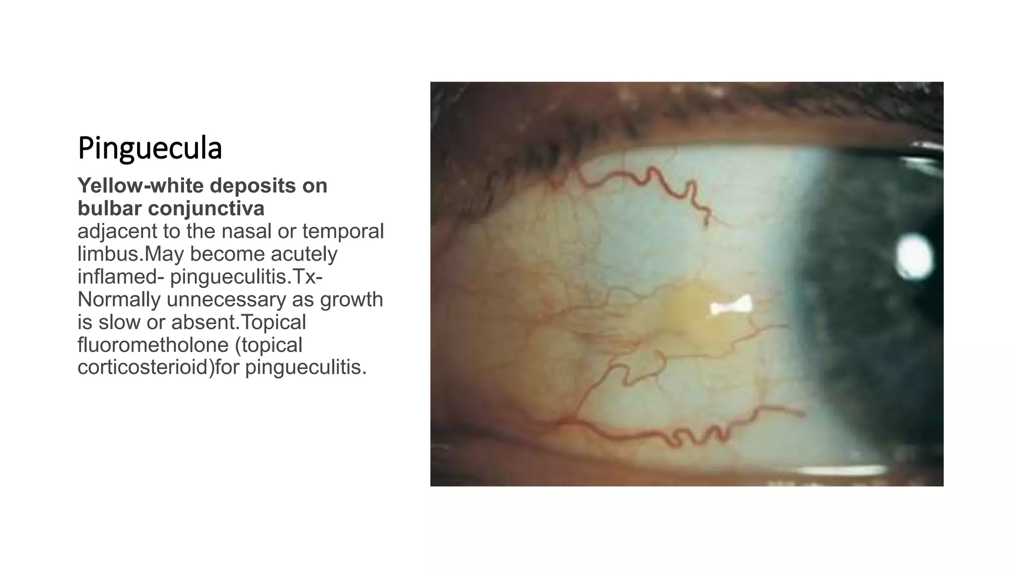 APPROACH TO RED EYE -DIAGNOSIS AND TREATMENT | PPTX
