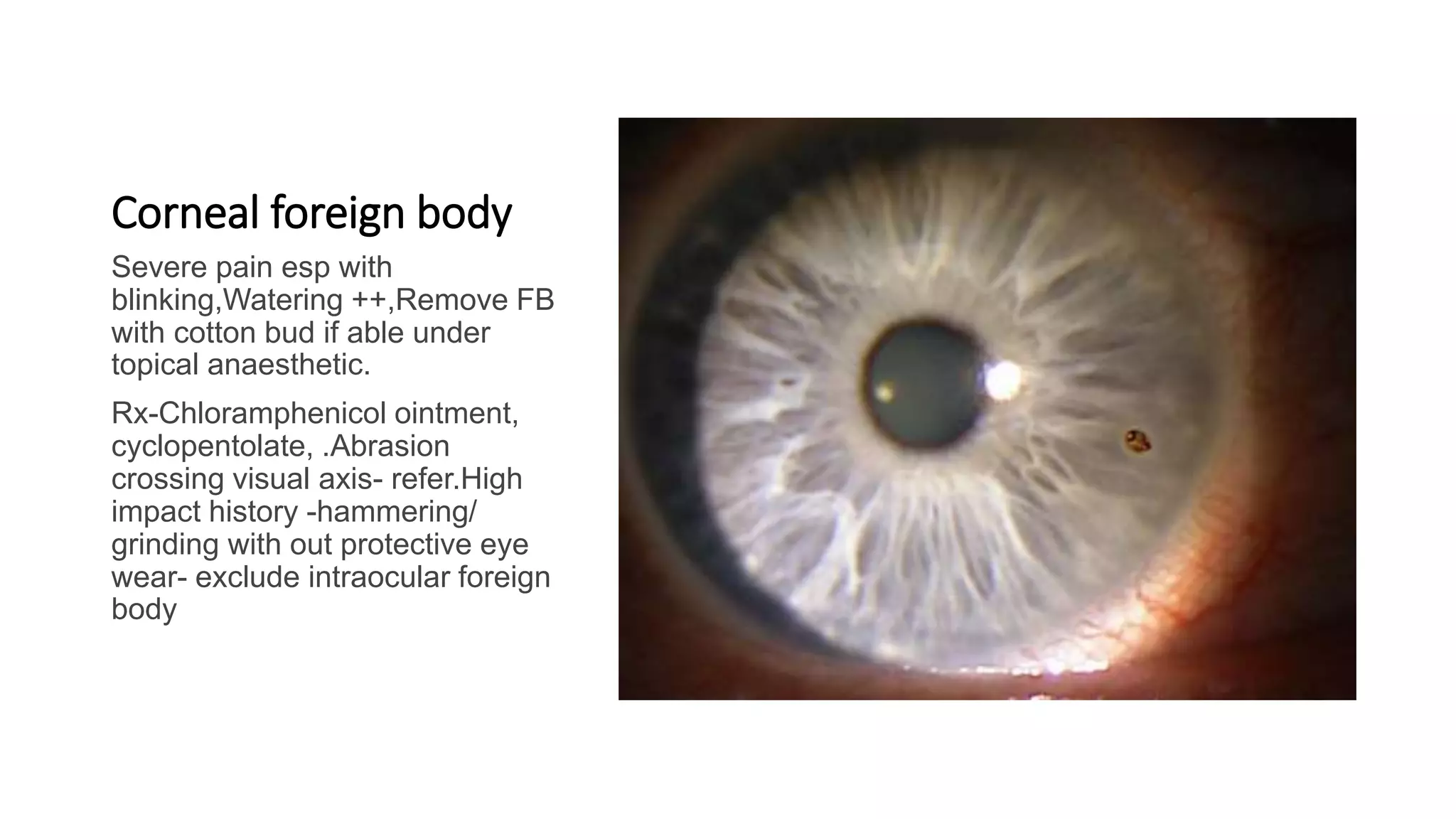 APPROACH TO RED EYE -DIAGNOSIS AND TREATMENT | PPTX