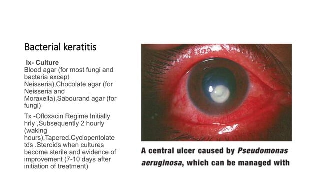APPROACH TO RED EYE -DIAGNOSIS AND TREATMENT | PPT
