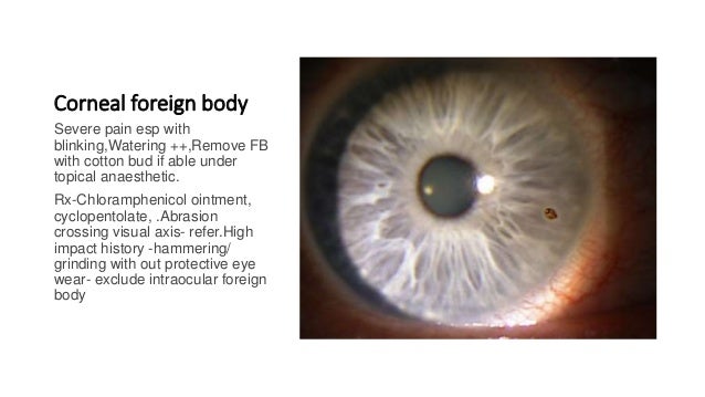 APPROACH TO RED EYE -DIAGNOSIS AND TREATMENT
