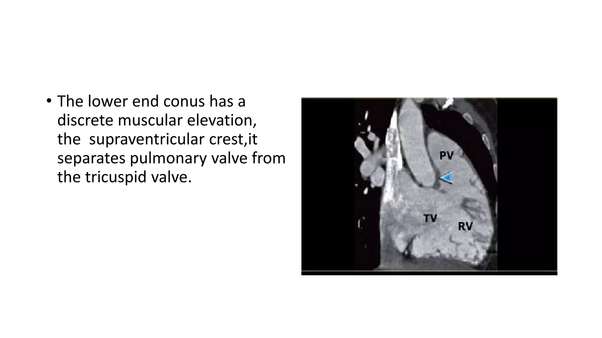 Cardiac anatomy and imaging techniques | PPTX
