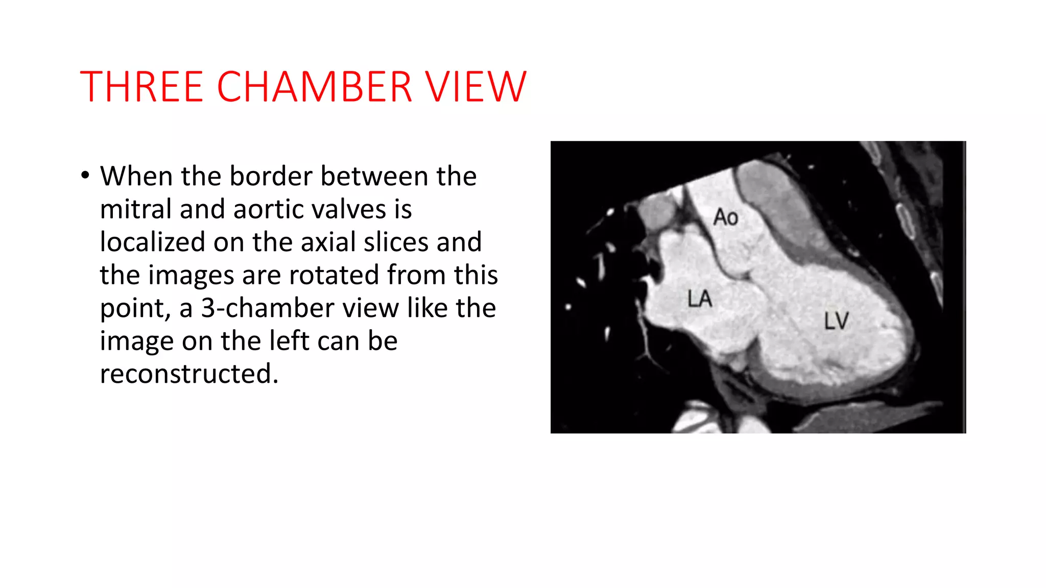 Cardiac anatomy and imaging techniques | PPTX
