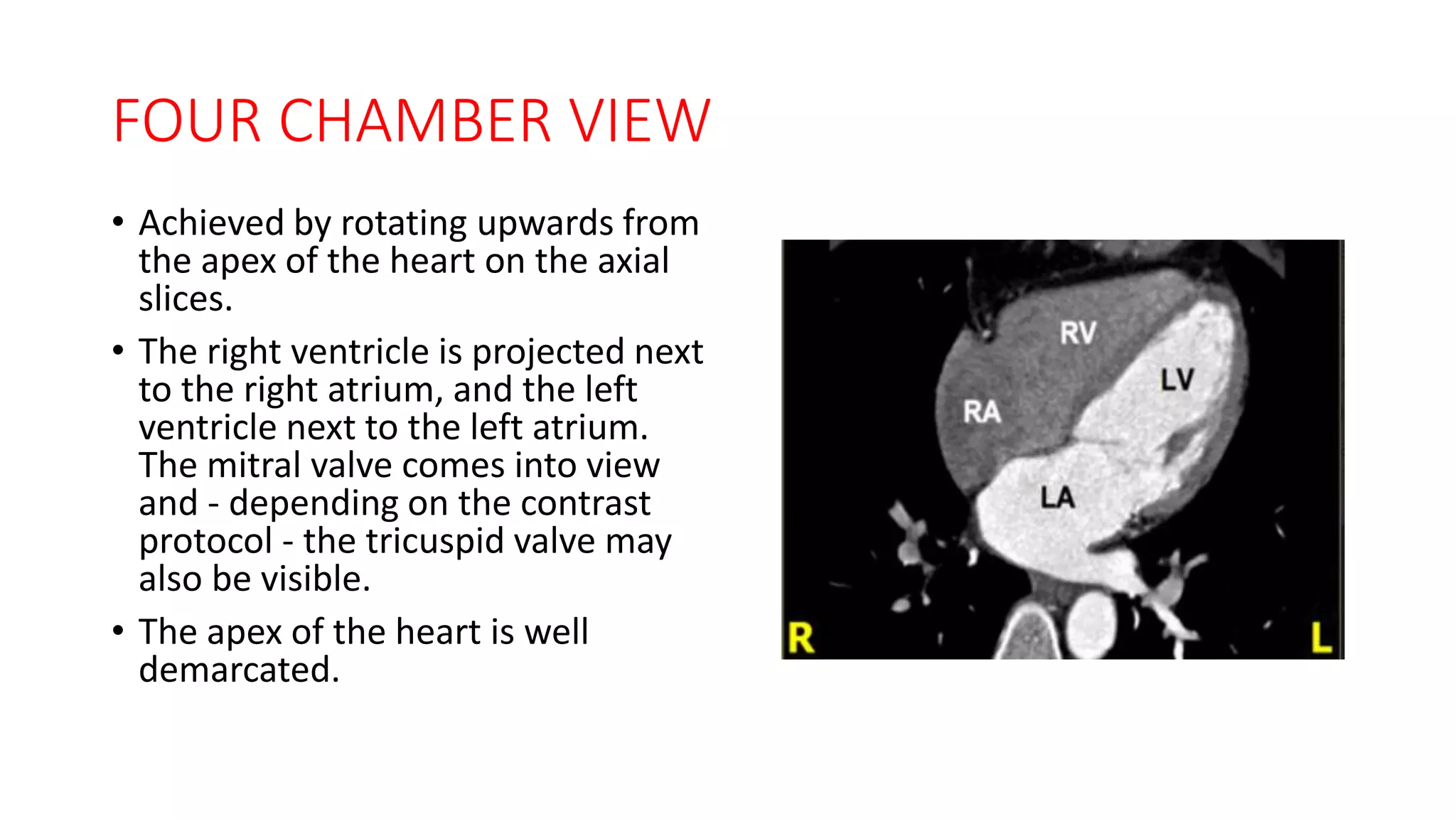 Cardiac anatomy and imaging techniques | PPTX