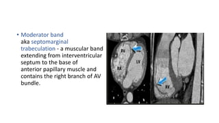 Cardiac anatomy and imaging techniques | PPT