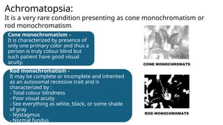 Comprehensive Overview of Color Vision: Anatomy, Physiology, Theories ...