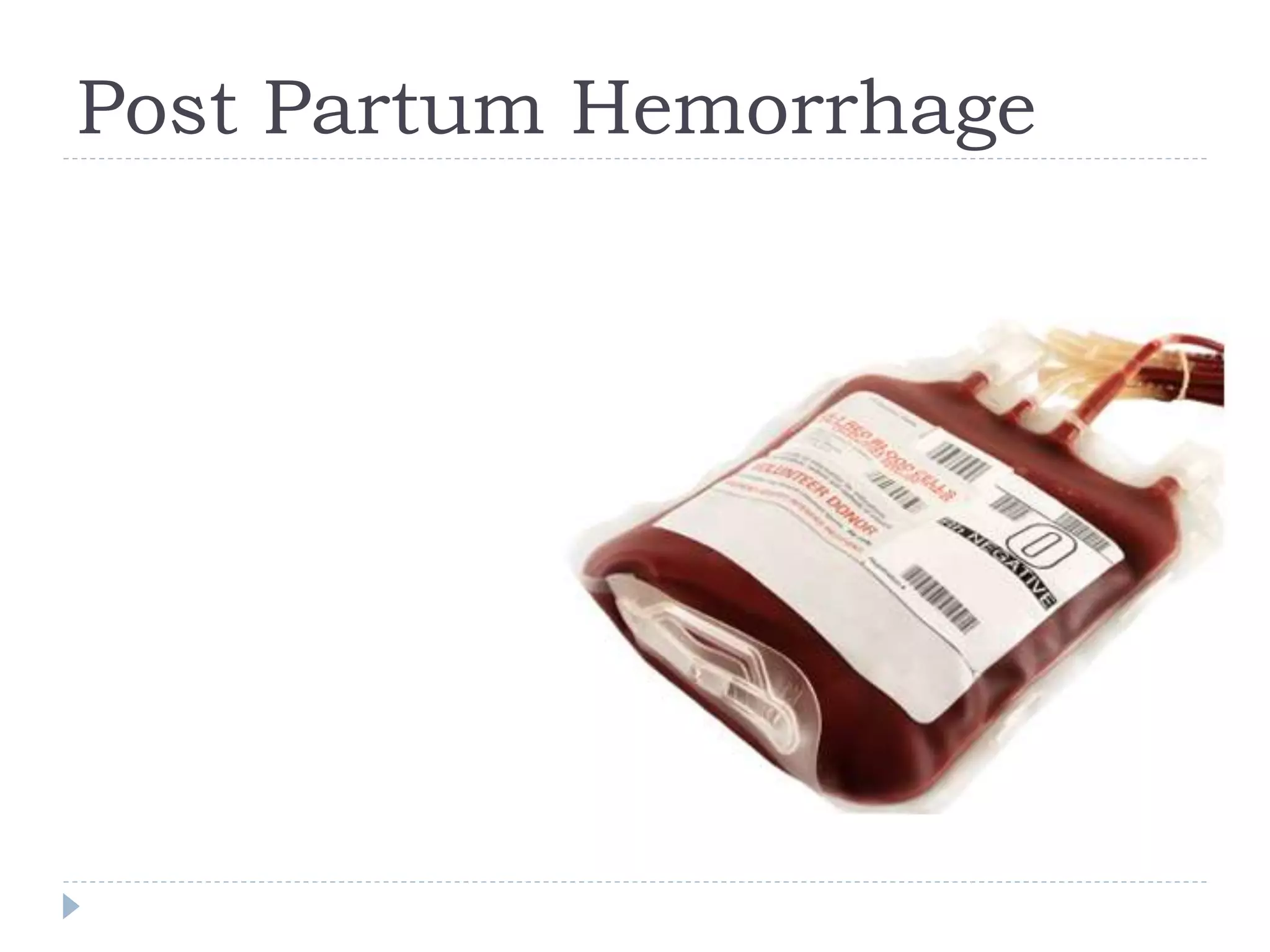 Post Partum Hemorrhage (PPH) | PPTX