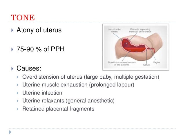 Post Partum Hemorrhage (PPH)
