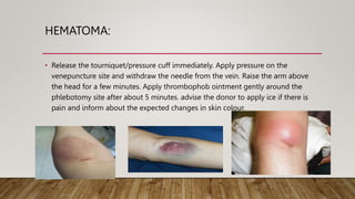 Presentation 150722 adverse donor reaction.pptx