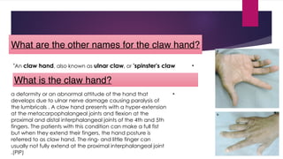 claw hand | PDF