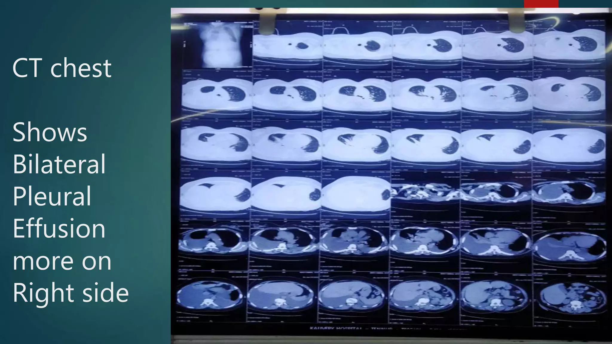 Presentation (16).pptx