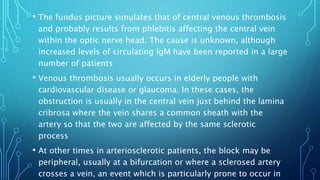 vascular occlusion of retina.pptx