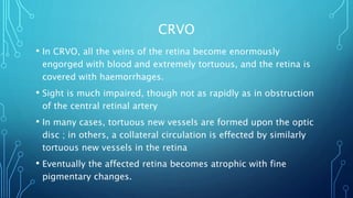 vascular occlusion of retina.pptx