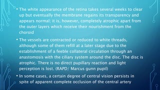 vascular occlusion of retina.pptx