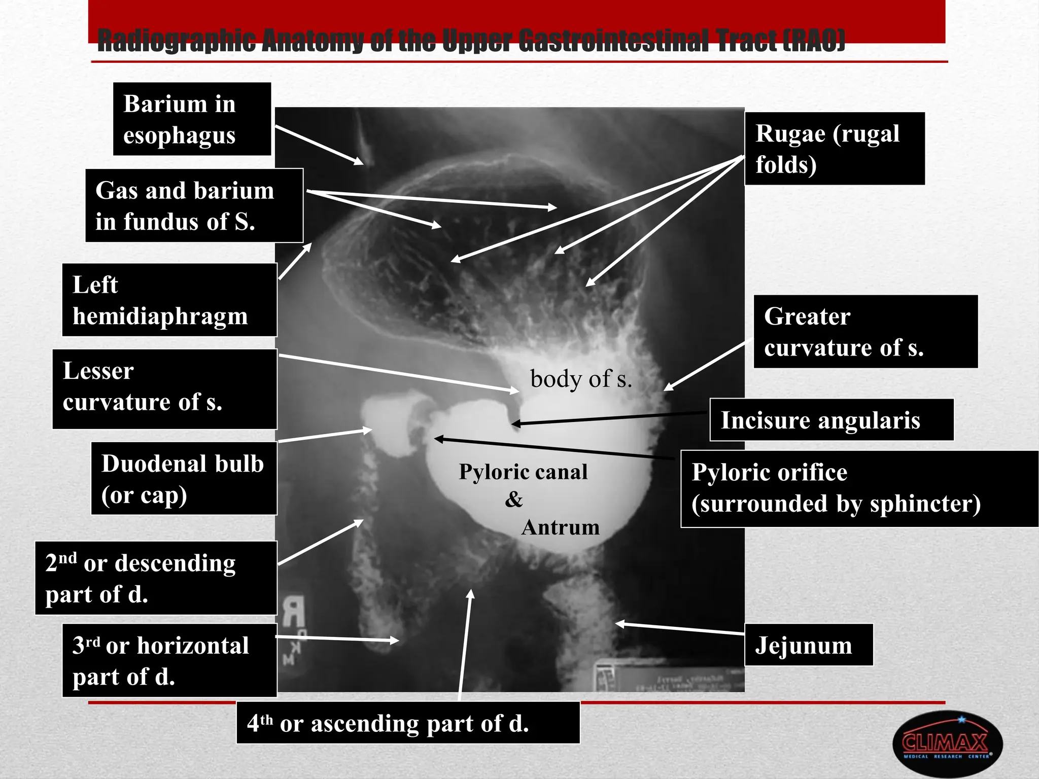 Presentation on flouroscopy (barium).pdf