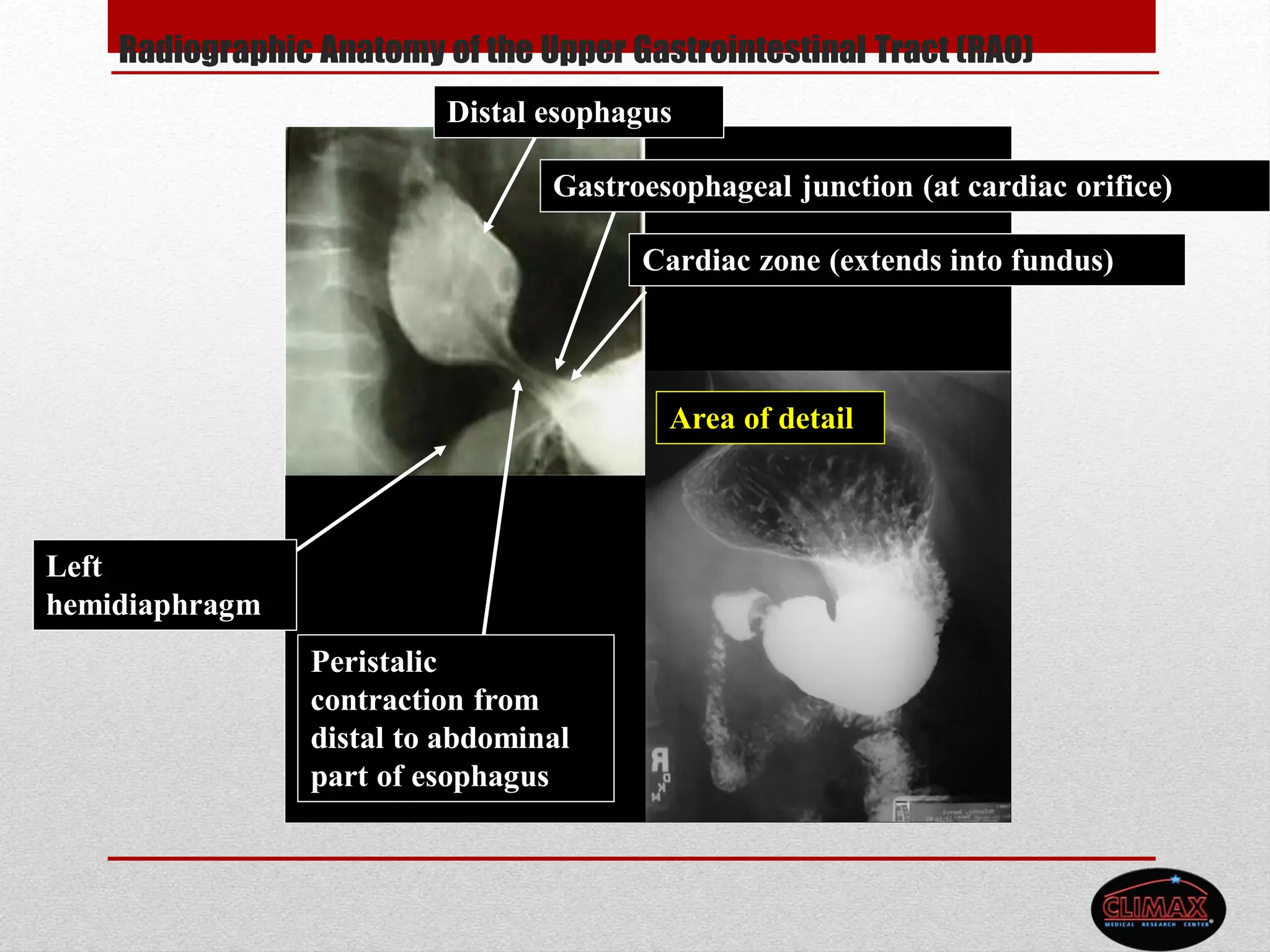 Presentation on flouroscopy (barium).pdf