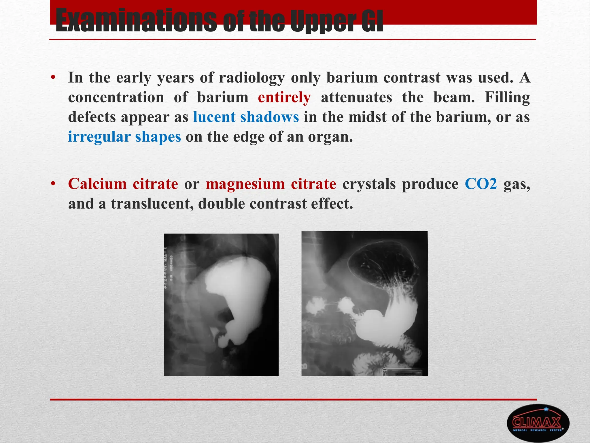 Presentation on flouroscopy (barium).pdf