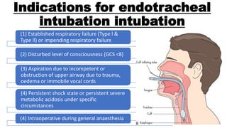 Postintubation cardiovascular collapse | PPTX