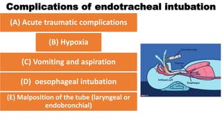 Postintubation cardiovascular collapse | PPTX