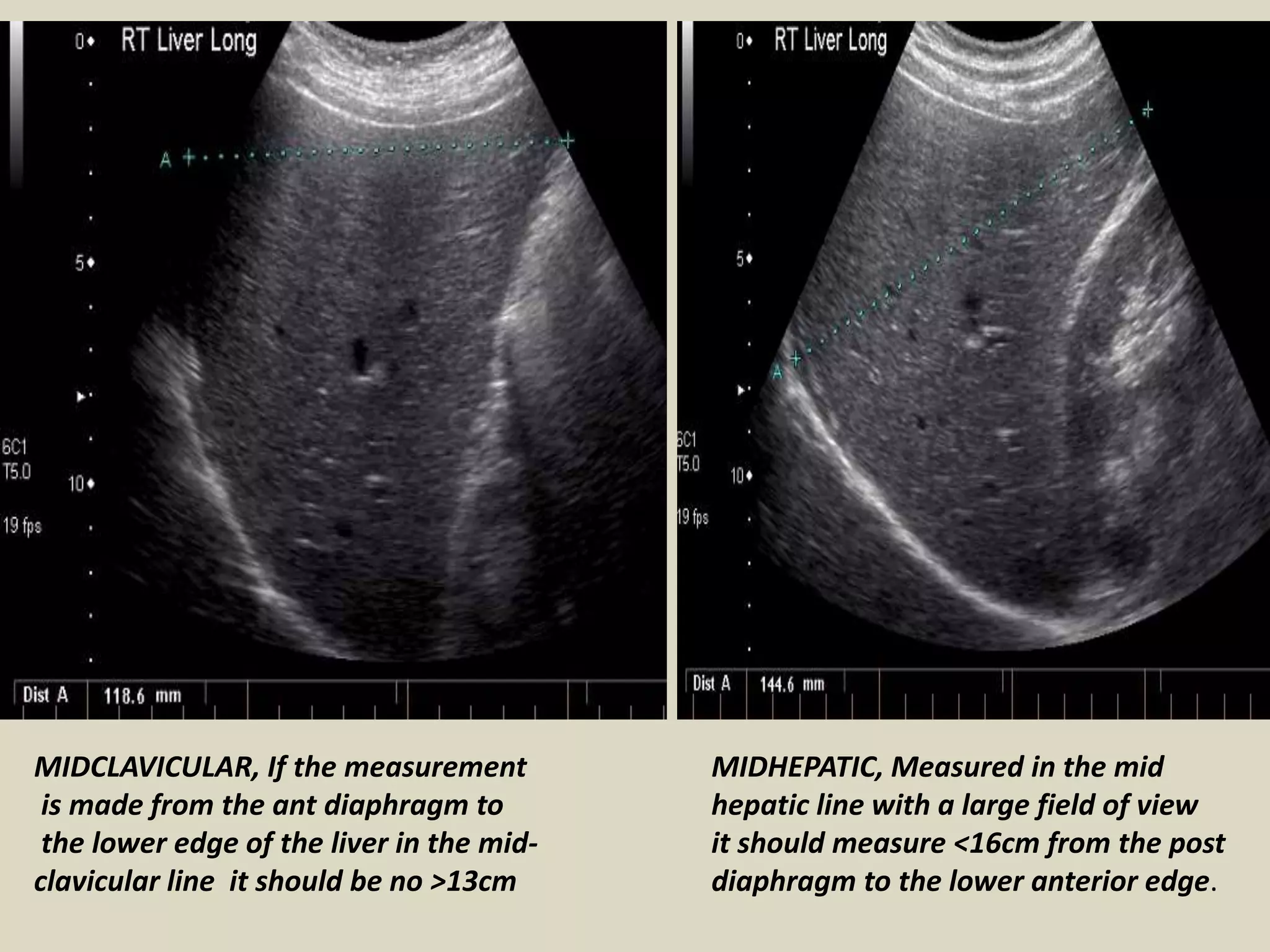Presentation1, abdominal ultrasound anatomy. | PPTX