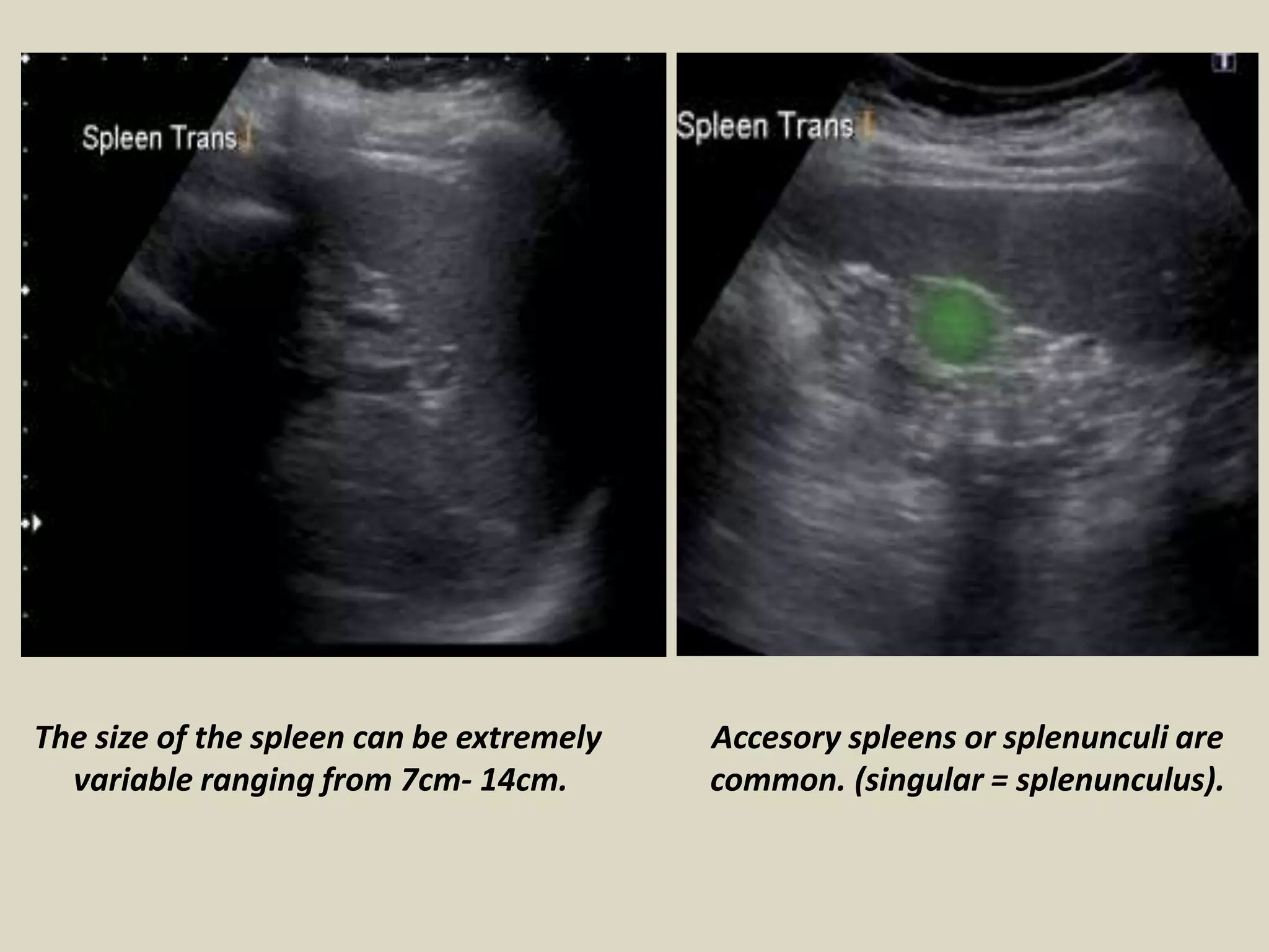 Presentation1, abdominal ultrasound anatomy. | PPTX