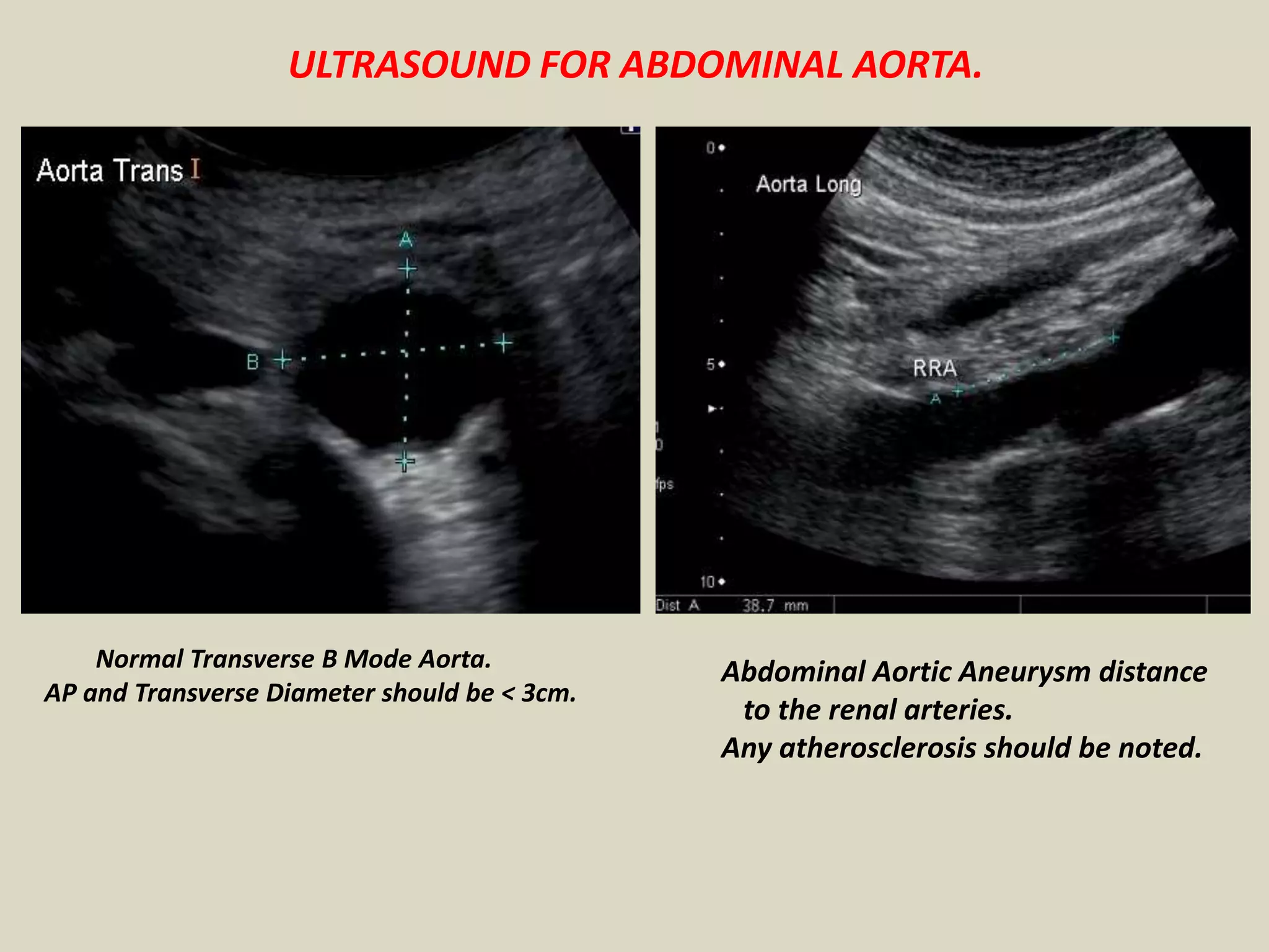 Presentation1, abdominal ultrasound anatomy. | PPTX