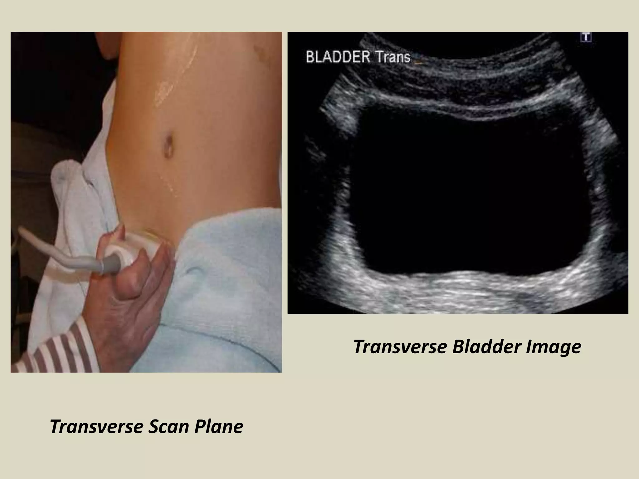 Presentation1, abdominal ultrasound anatomy. | PPTX