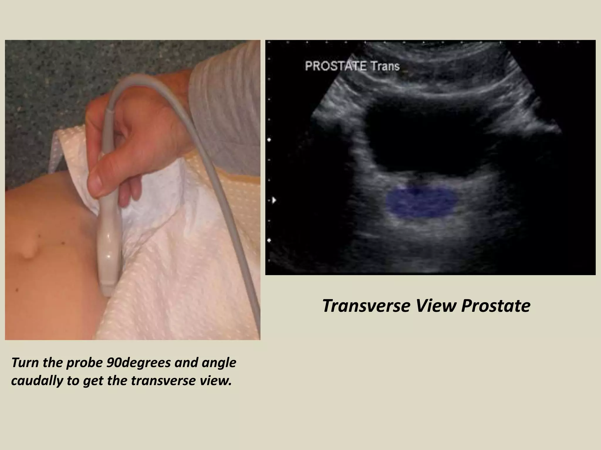 Presentation1, abdominal ultrasound anatomy. | PPTX