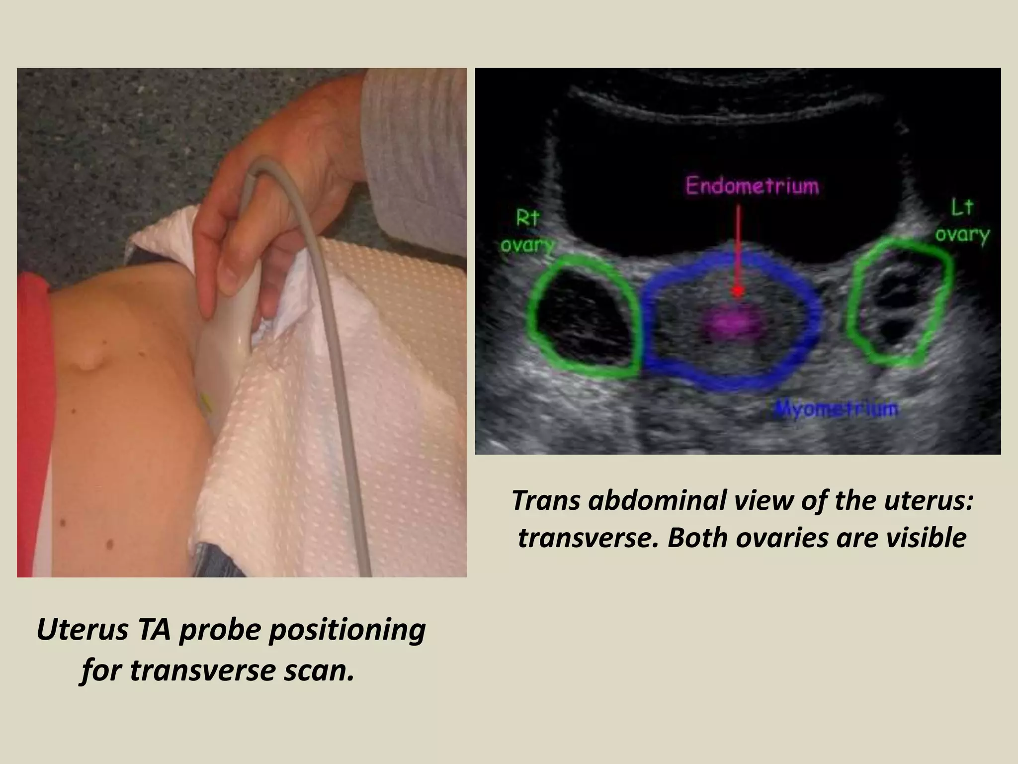 Presentation1, abdominal ultrasound anatomy. | PPTX