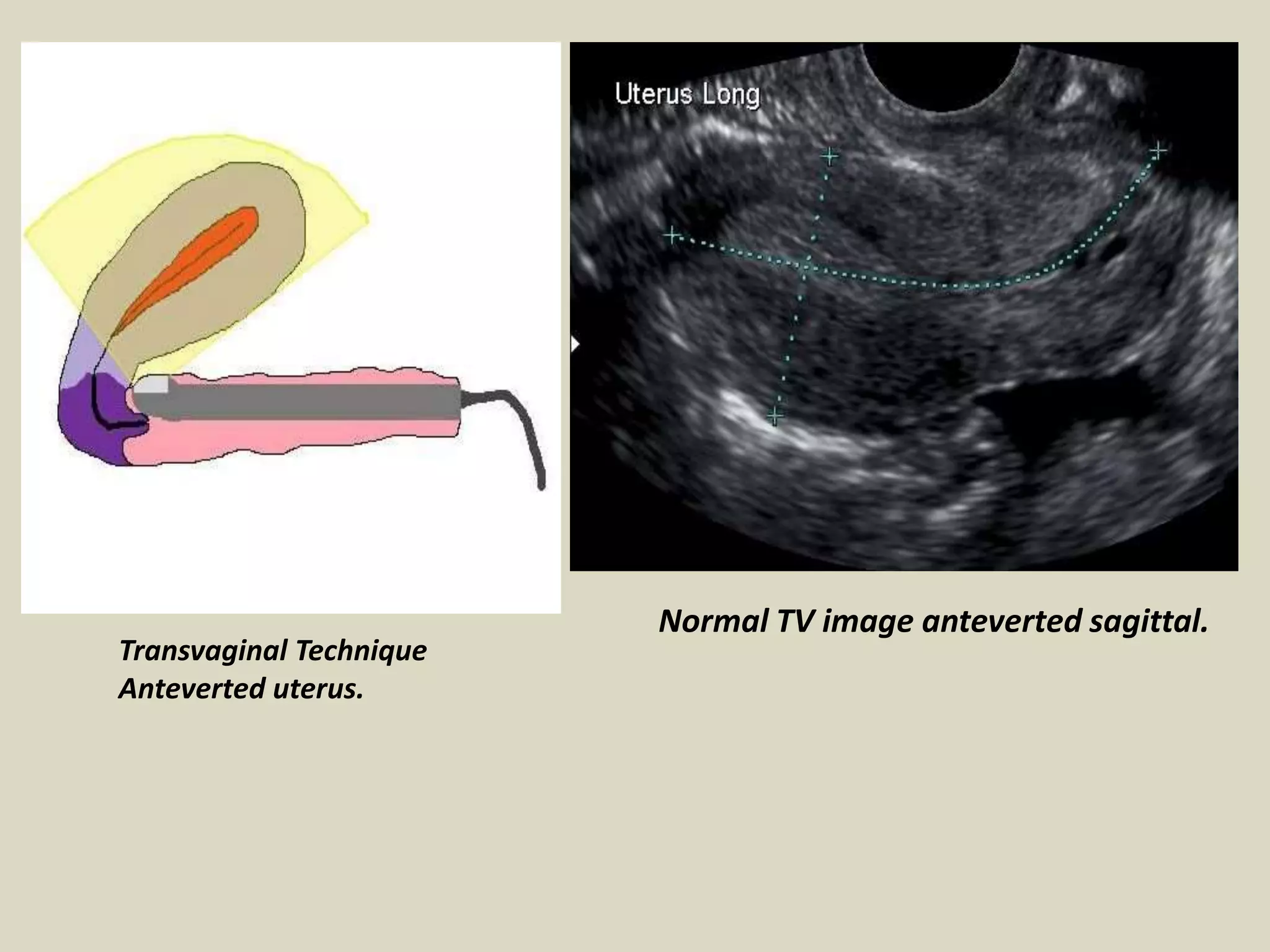 Presentation1, abdominal ultrasound anatomy. | PPTX