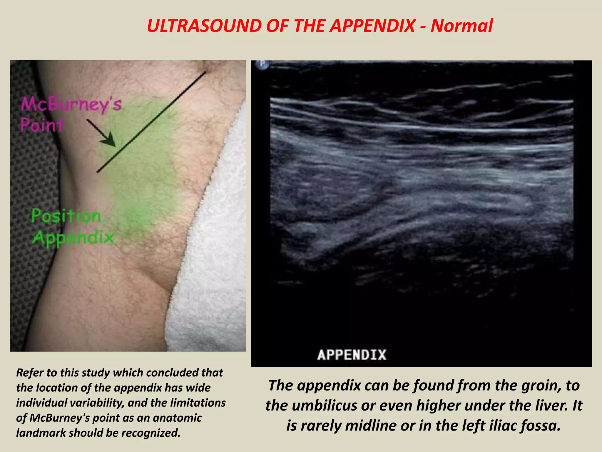 Presentation1, abdominal ultrasound anatomy. | PPTX