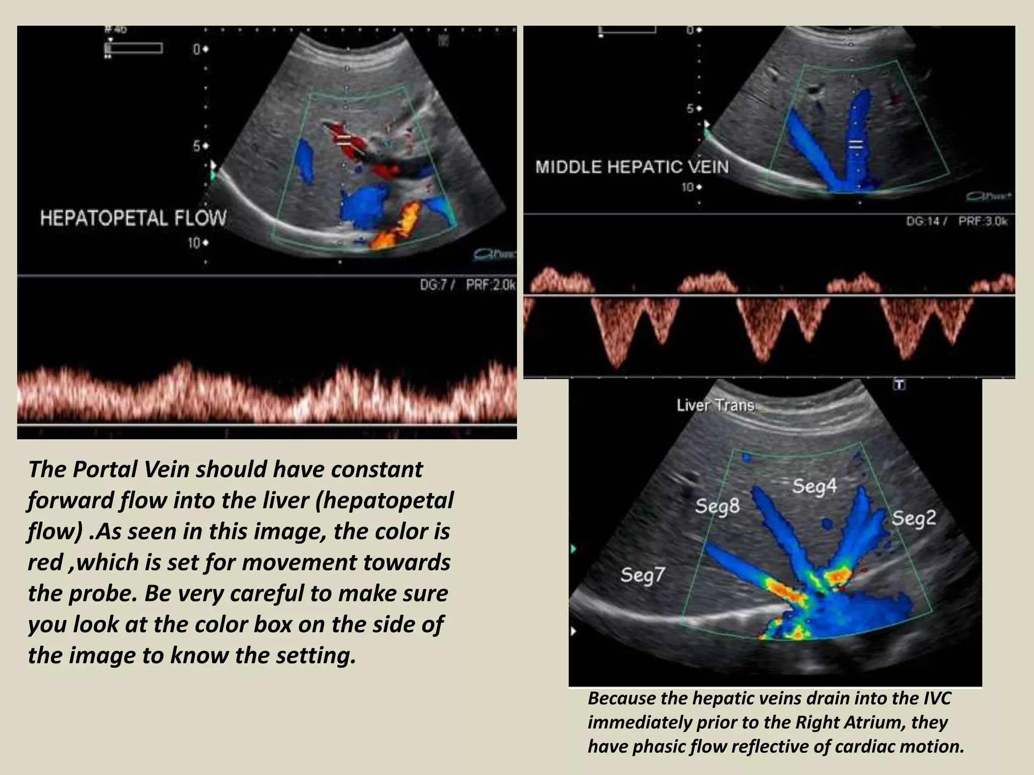 Presentation1, abdominal ultrasound anatomy. | PPTX