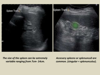 Presentation1, abdominal ultrasound anatomy. | PPTX