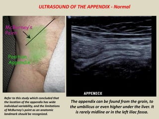 Presentation1, abdominal ultrasound anatomy. | PPTX