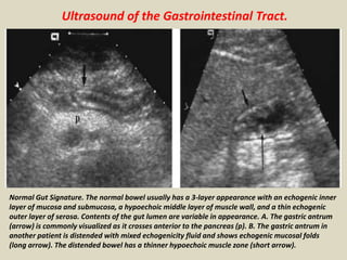 Presentation1, abdominal ultrasound anatomy. | PPTX