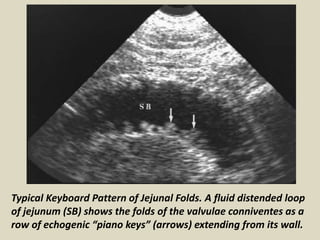 Presentation1, abdominal ultrasound anatomy. | PPTX