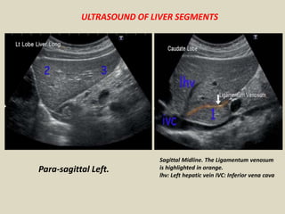 Presentation1, abdominal ultrasound anatomy. | PPTX